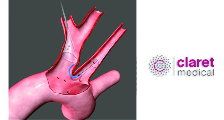 MassDevice Q&A: Claret Medical's Azin Parhizgar on trying to make TAVR ...