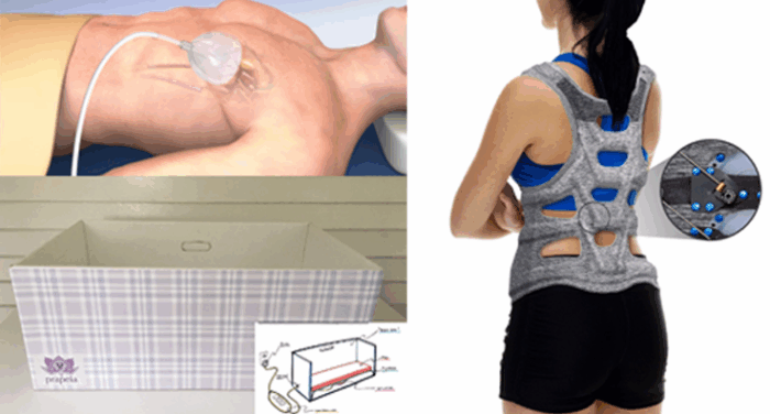 6 innovative pediatric devices you need to know - MassDevice