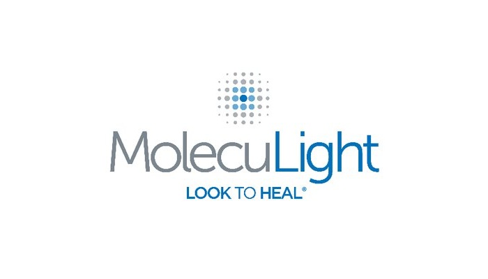 MolecuLight wins FDA clearance for handheld imaging device - MassDevice