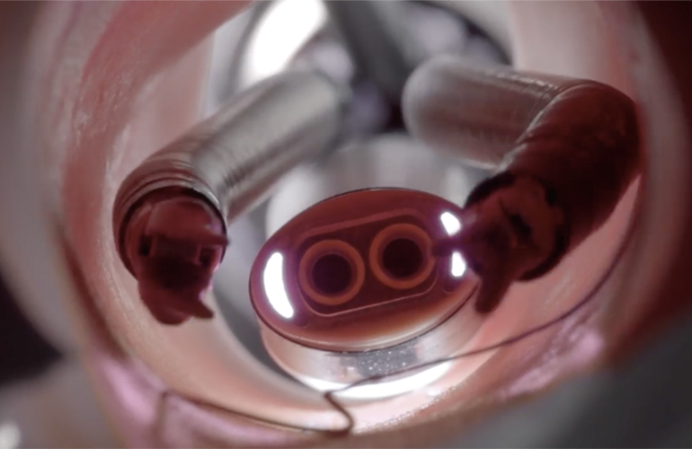 Here’s how Intuitive Surgical is innovating to stay competitive ...