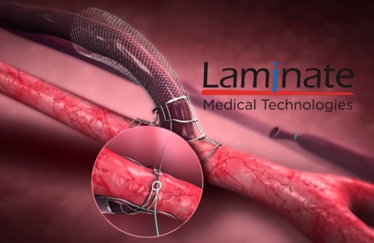 Laminate Medical brings in $12m for dialysis vascular support device ...