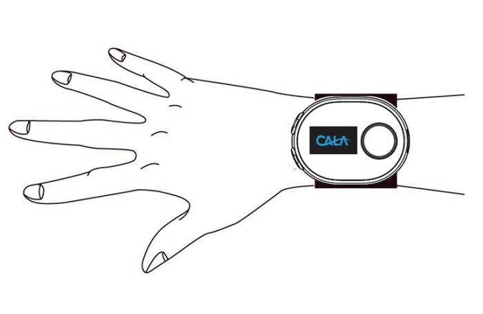 Cala Health launches trial for Cala Two neurostim device for essential ...