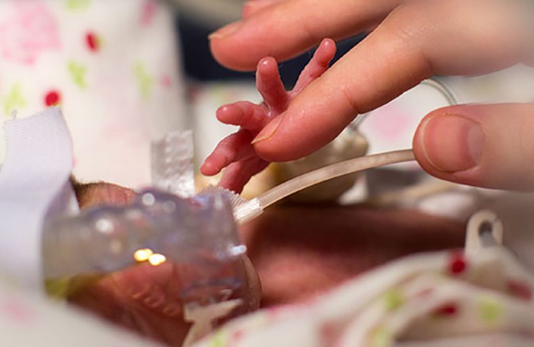 Here's how a new Abbott device is making a difference among neonatal ...