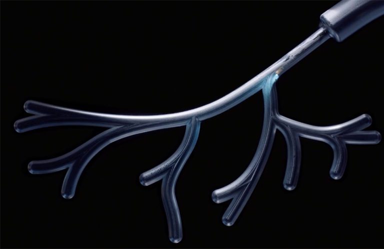 Ablation is the next step for Intuitive's Ion system | MassDevice