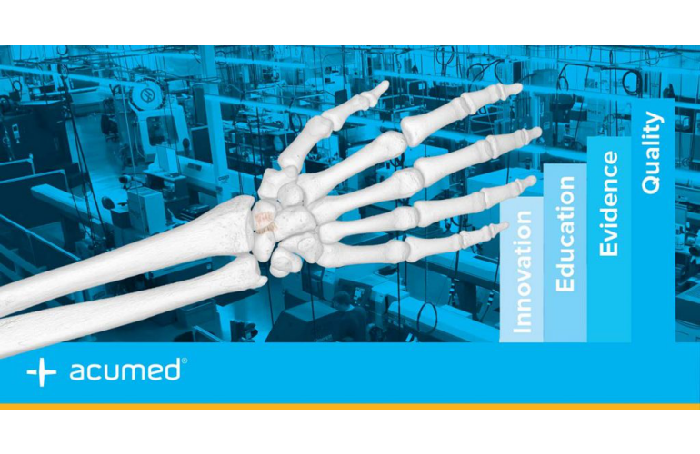 Acumed buys Radicle Ortho's RASL wrist implant - MassDevice