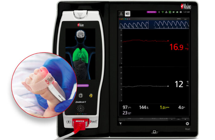 Masimo lands CE Mark for infant hemoglobin monitor - MassDevice