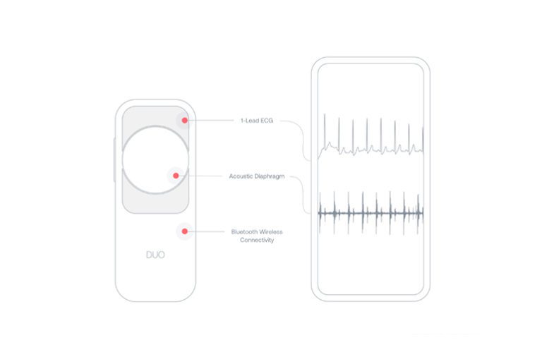 Eko raises $20m Series B for smart cardiac monitor | Funding Roundup ...