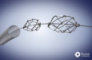 Surmodics has real-world Pounce thrombectomy system findings