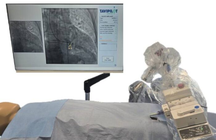 Caranx announces first clinical use of autonomous robot for TAVI