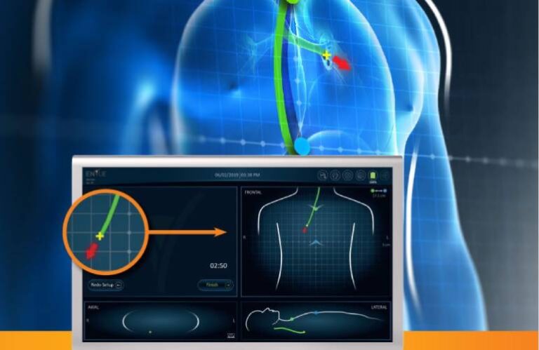 NanoVibronix to rebrand with focus on ENvue tech