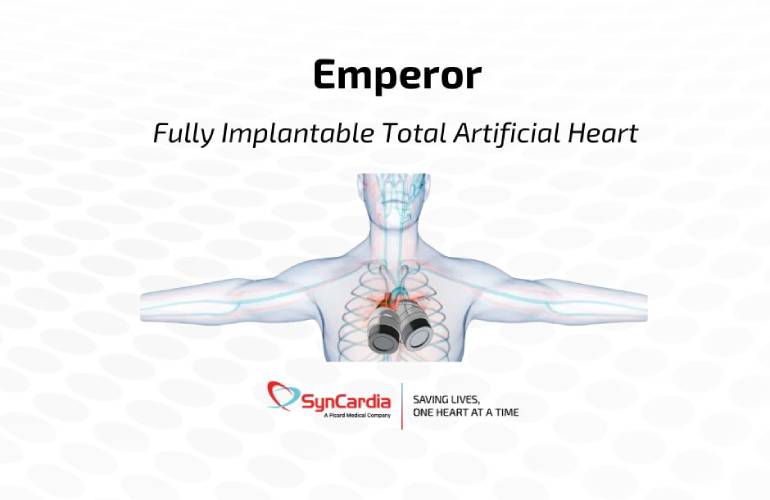 SynCardia touts first in vivo implants for next-gen artificial heart