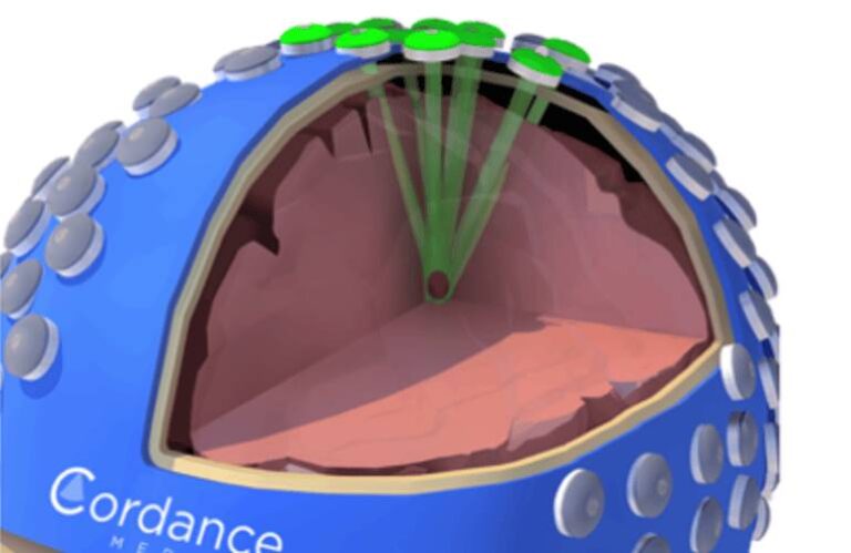 Cordance raises $8M for ultrasound used in brain treatment
