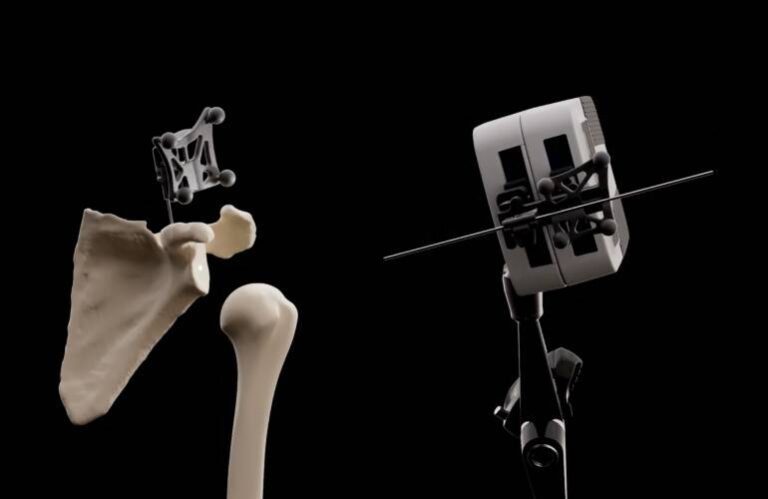 Interventional Systems, Shoulder Innovations partner on robotics