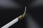 Francis Medical wins FDA nod for water vapor ablation system