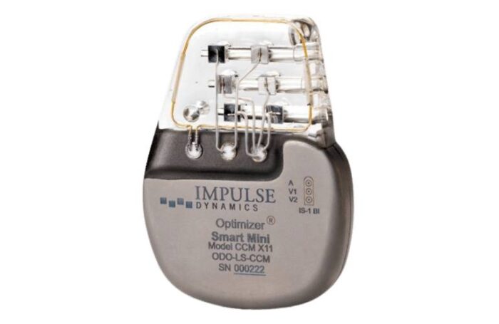 Impulse Dynamics raises $158M for heart failure treatment