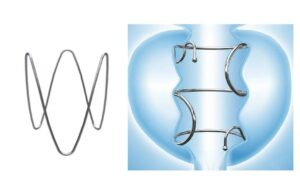 ProVerum, Zenflow win FDA nods for BPH treatment devices