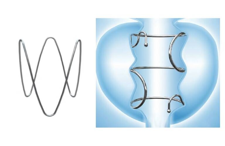 ProVerum, Zenflow win FDA nods for BPH treatment devices