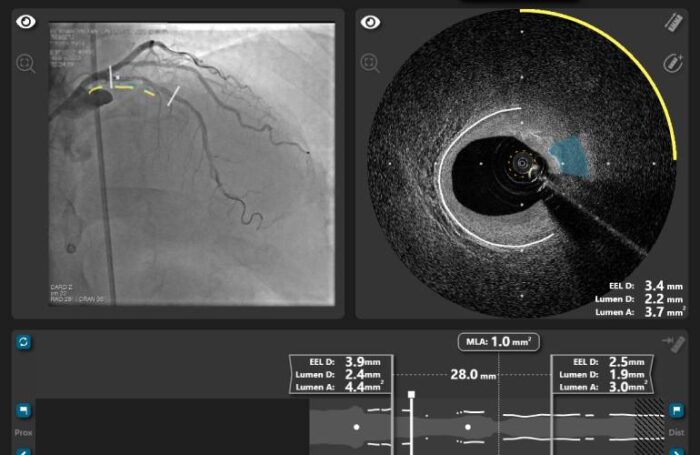Philips to acquire AI-powered imaging tech developer Spectrawave