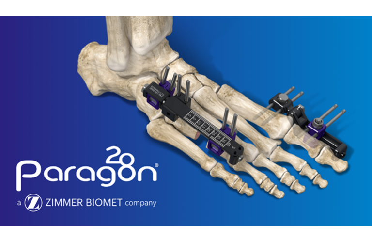 Zimmer Biomet launches new foot and ankle system