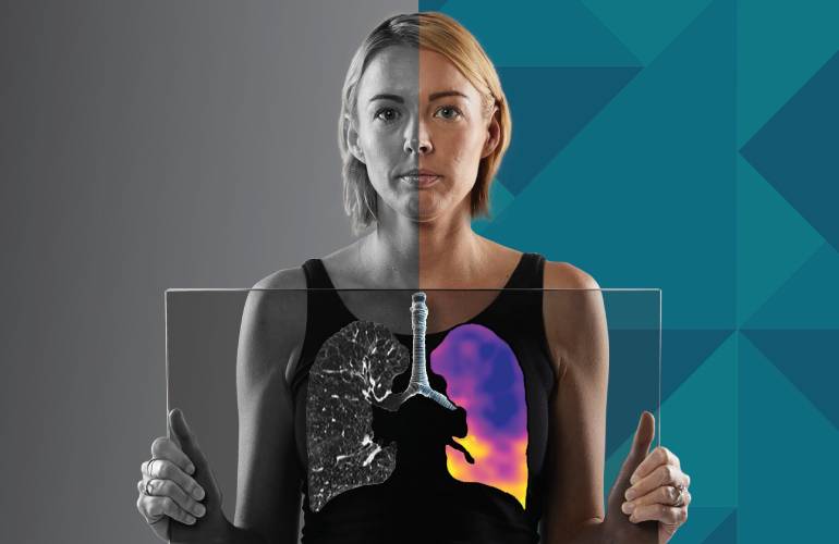 4DMedical raises $100M for software-based lung imaging tech