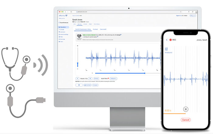 FDA clears eMurmur's next-gen AI heart murmur detection software