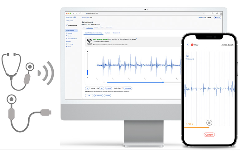 FDA clears eMurmur's next-gen AI heart murmur detection software