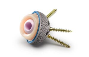 Zimmer Biomet gets FDA nod for new G7 hip implant