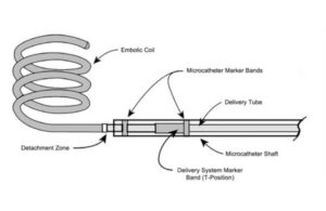 FDA says recall of J&J's Cerenovus detachable coils is serious
