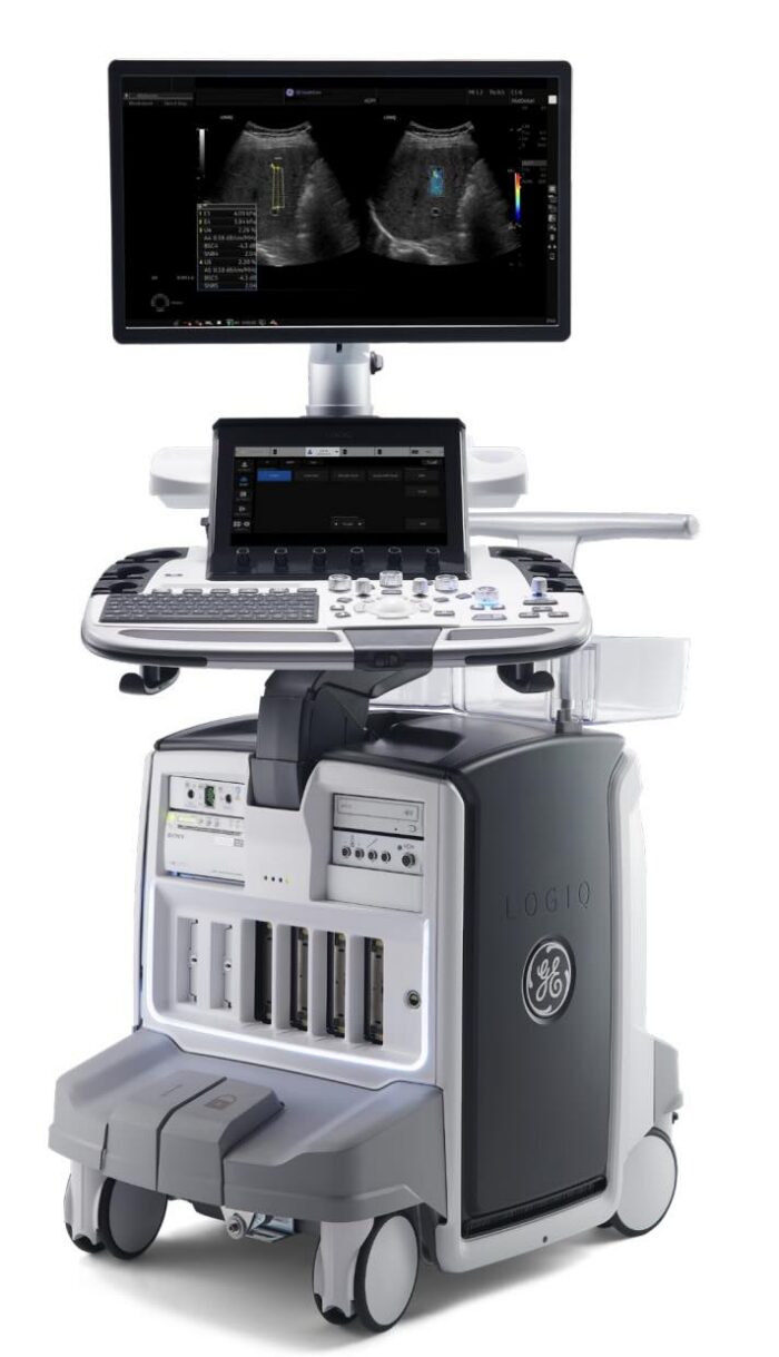 GE HeathCare debuts next-generation LOGIQ ultrasound systems