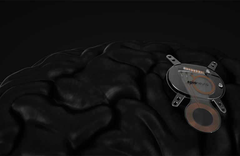 Epia Neuro launches to develop BCI tech for post-stroke care