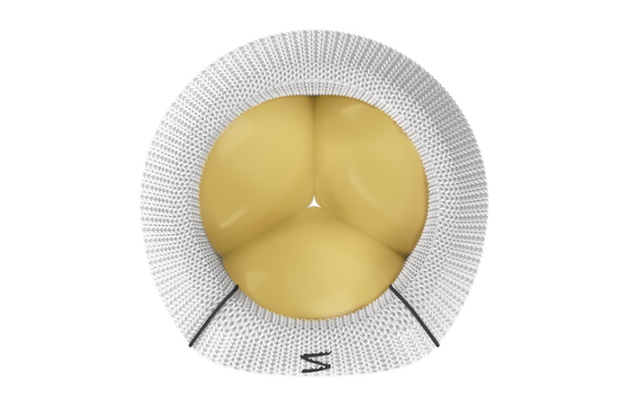 Edwards gets FDA nod for Triformis Resilia tricuspid valve