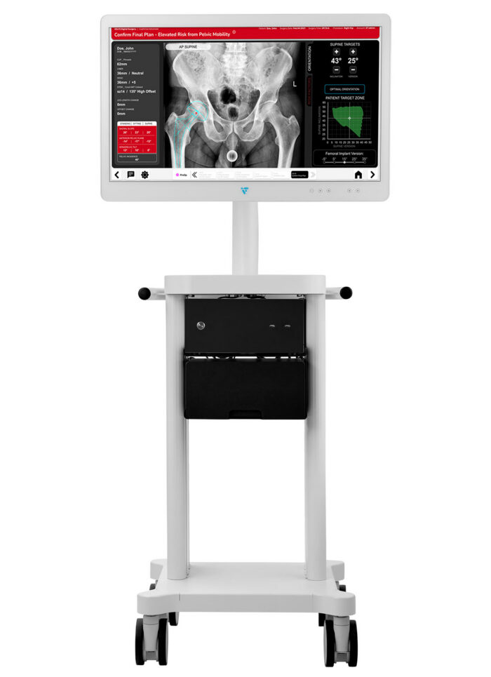 J&J's DePuy Synthes launches Velys Hip Navigation with AI