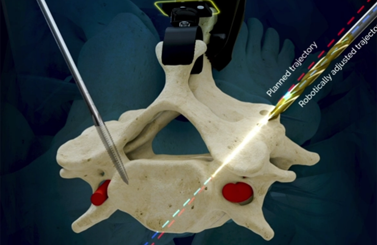 LEM Surgical wins new FDA clearance for humanoid surgical robot