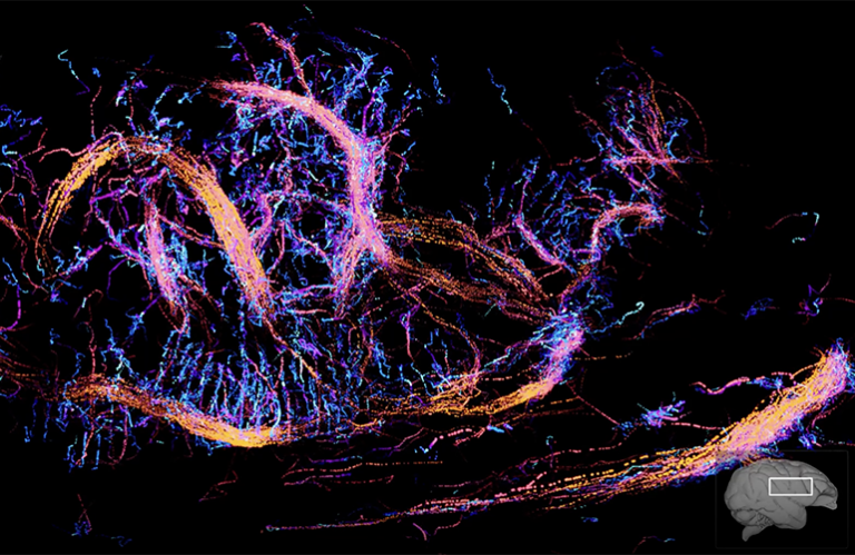 Aleph Neuro launches with high-res brain images using ultrasound